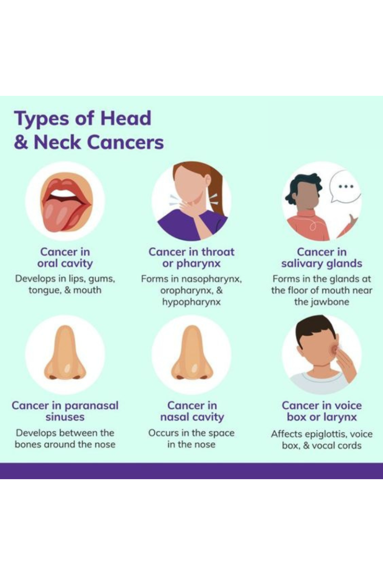 Head and Neck Cancer - North Houston Cancer Clinics