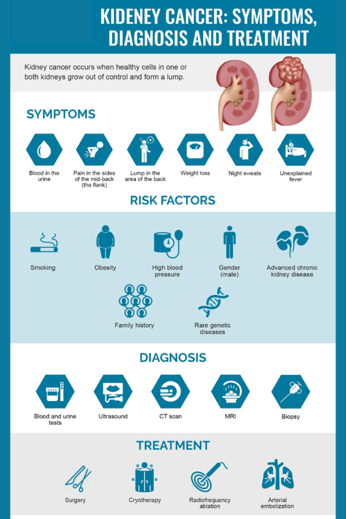 Kidney Cancer - North Houston Cancer Clinics