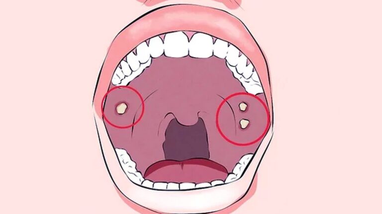 Oral Cancer Treatments, Causes & Symptoms - NHCancerClinics