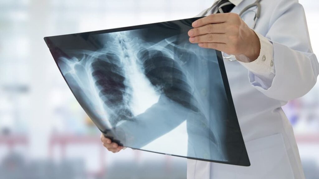 X-Rays - North Houston Cancer Clinics