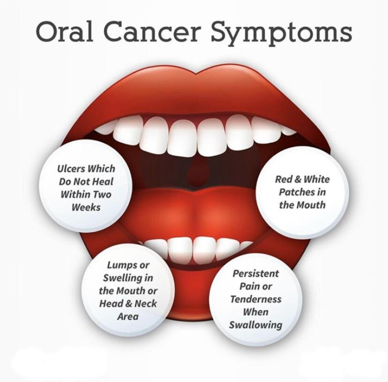 Spotting Mouth Ulcers vs. Oral Cancer Early Signs